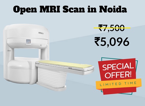 Get 30% Off on Open MRI Scan Cost in Noida: ₹5096 Only | mfine.co